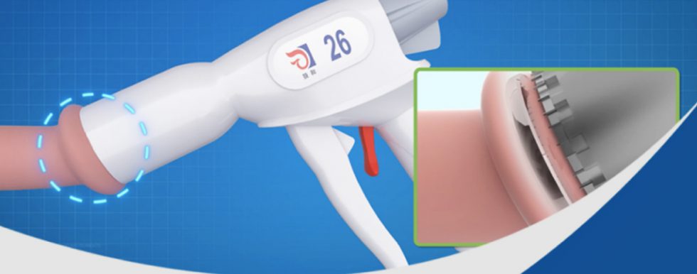Circumcision - Urologie-Erlangen